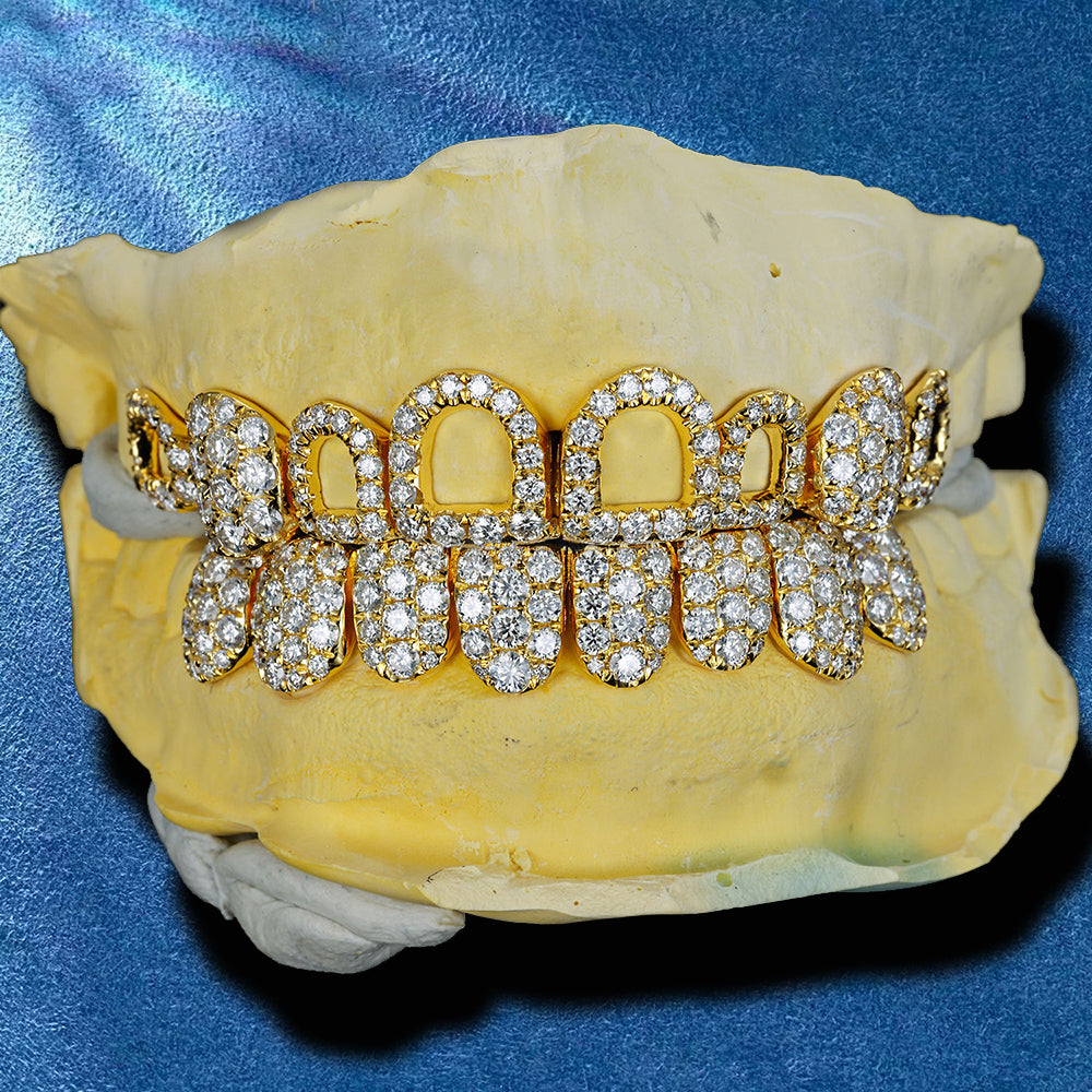 Custom 925 Sterling Silver Moissanite Open Face Grillz – Handmade Iced ...