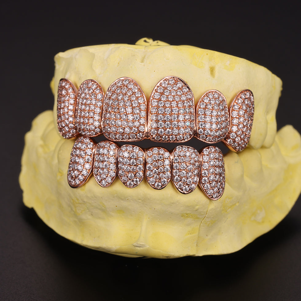 Iced Out Grillz for Men & Women – Custom Moissanite Teeth | IceZeus ...