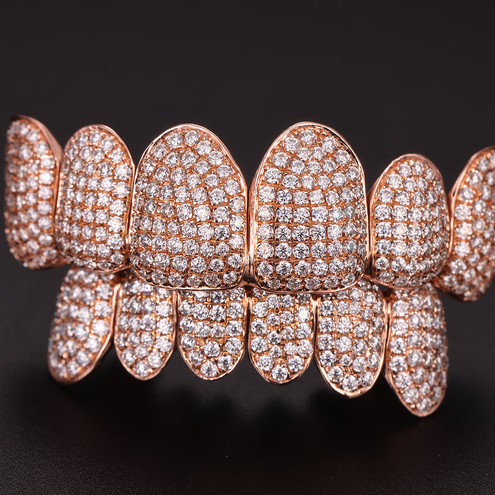 Iced Out Grillz for Men & Women – Custom Moissanite Teeth | IceZeus ...