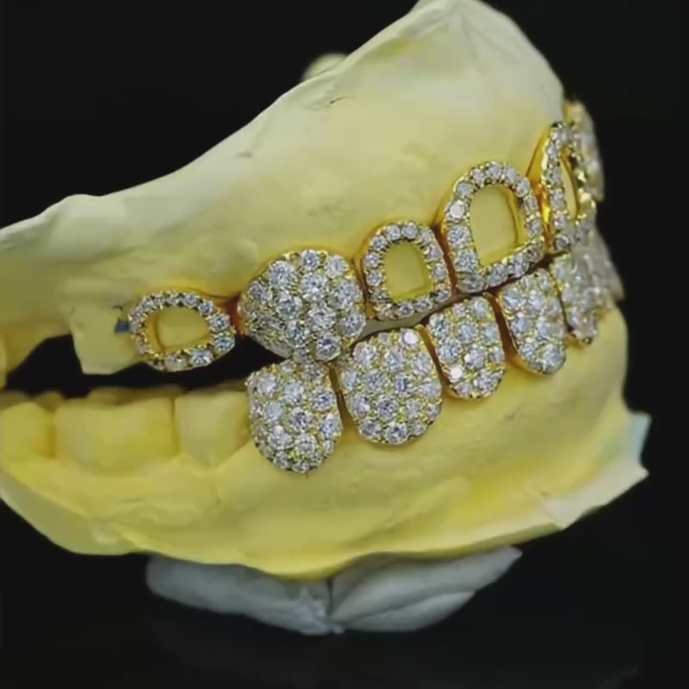 Custom 925 Sterling Silver Moissanite Open Face Grillz – Handmade Iced ...
